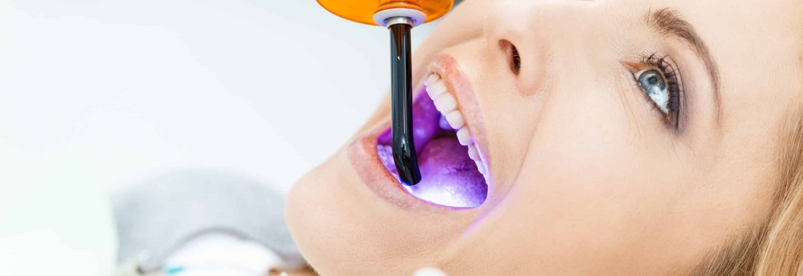 Dentist In Syracuse Utah | VIP Smiles Family Dentistry