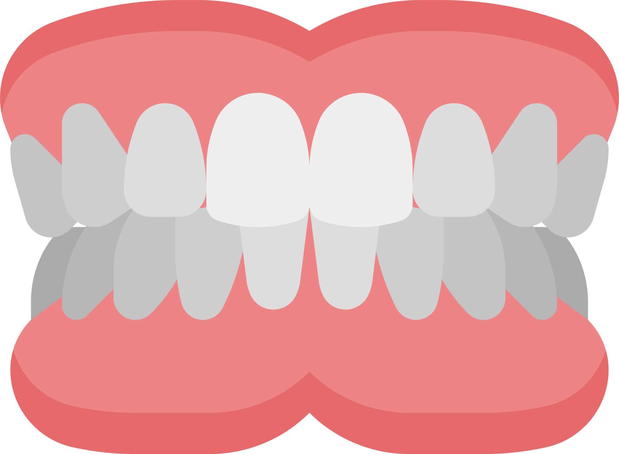 Blue Or Grey Teeth: Causes And Options For Treatment | VIP Smiles Dental