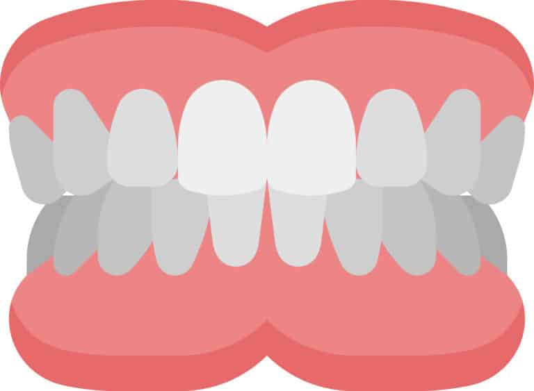 Blue Or Grey Teeth: Causes And Options For Treatment | VIP Smiles Dental